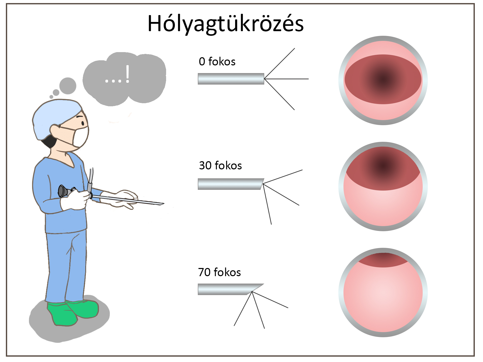Tünetek és diagnózis - Urodoki